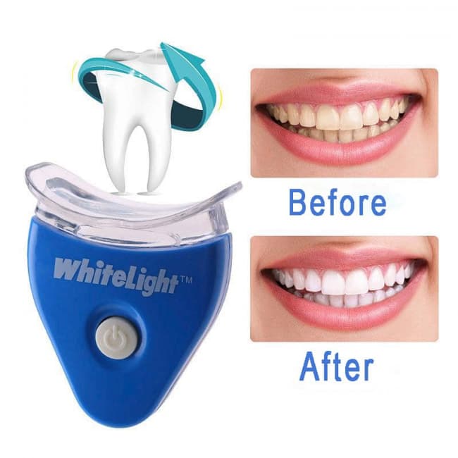 WhiteLight Tooth Whitener Set | Tech Import World